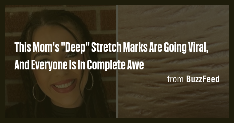 This Mom's "Deep" Stretch Marks Are Going Viral, And Everyone Is In ...