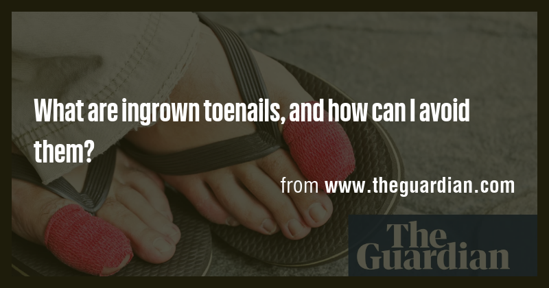 What are ingrown toenails, and how can I avoid them? - Briefly