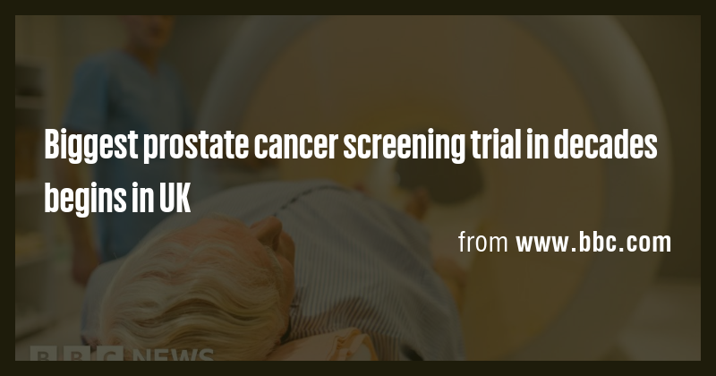 Biggest prostate cancer screening trial in decades begins in UK - Briefly