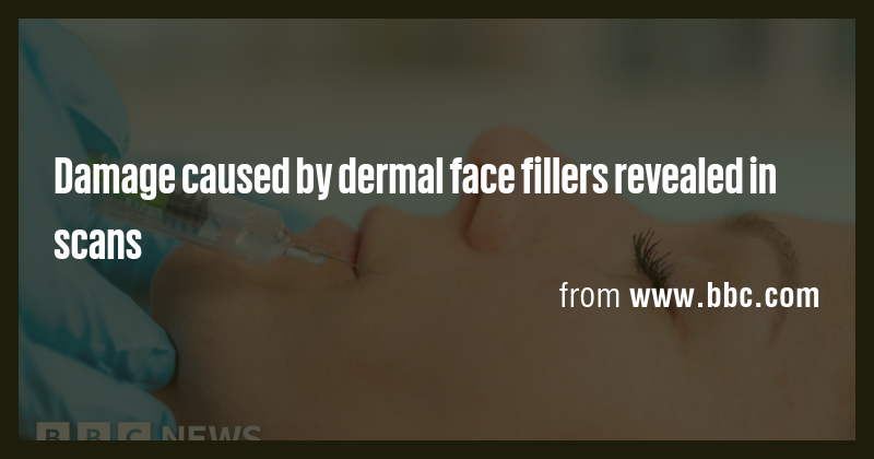 Damage caused by dermal face fillers revealed in scans - Briefly