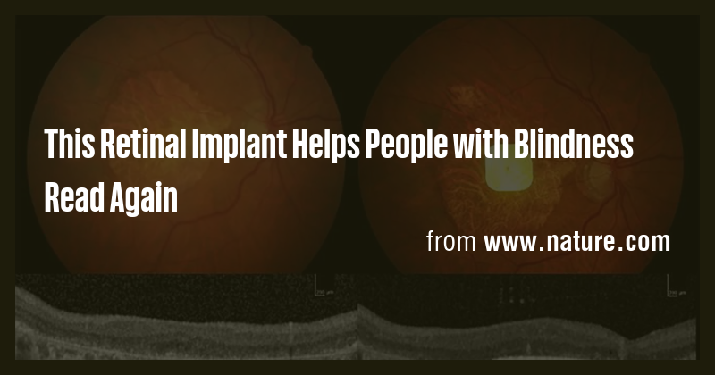 This Retinal Implant Helps People with Blindness Read Again - Briefly